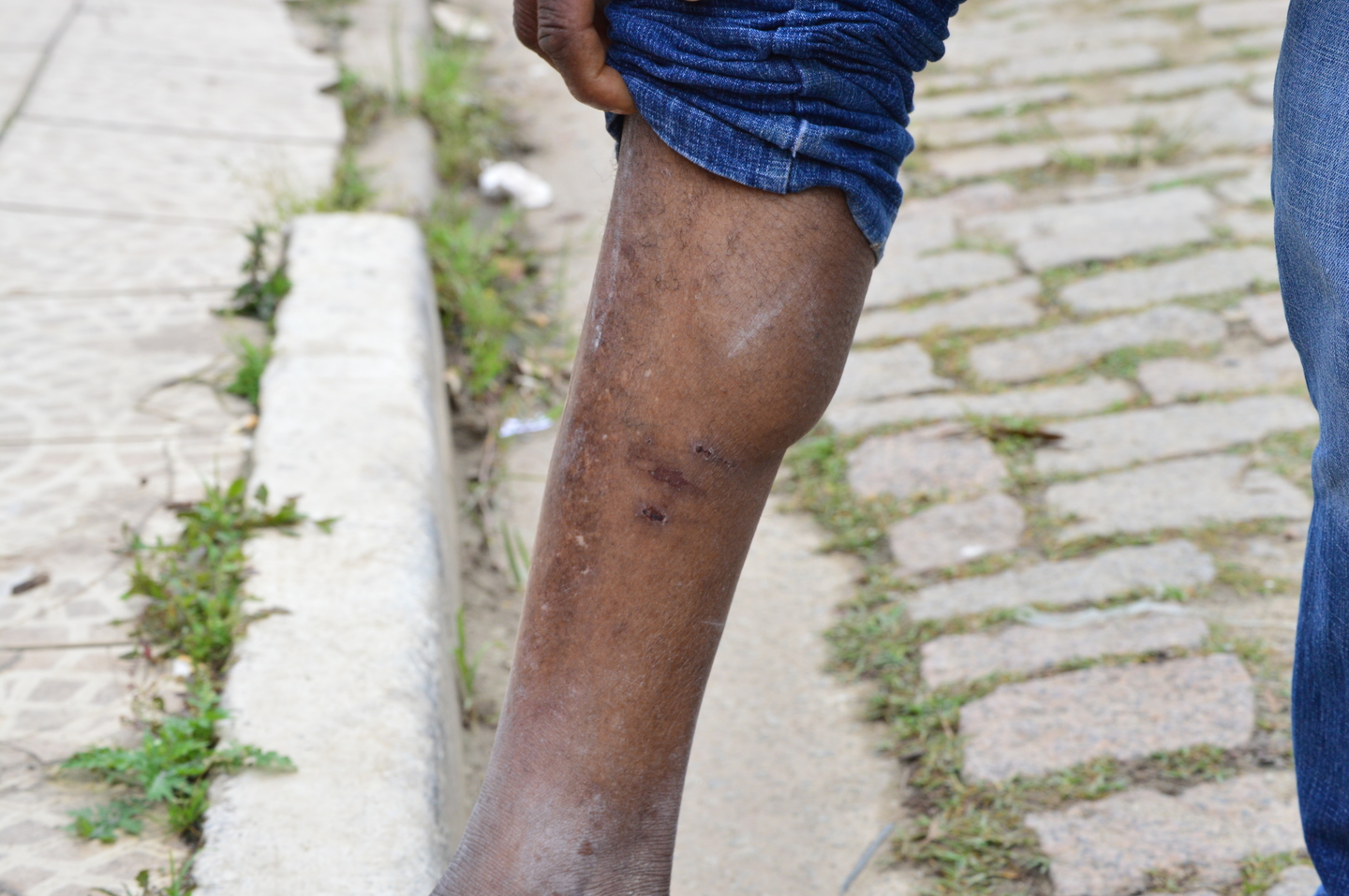 Animal abandonado ataca com mordidas no Jd. Fernandes - Diário de Suzano